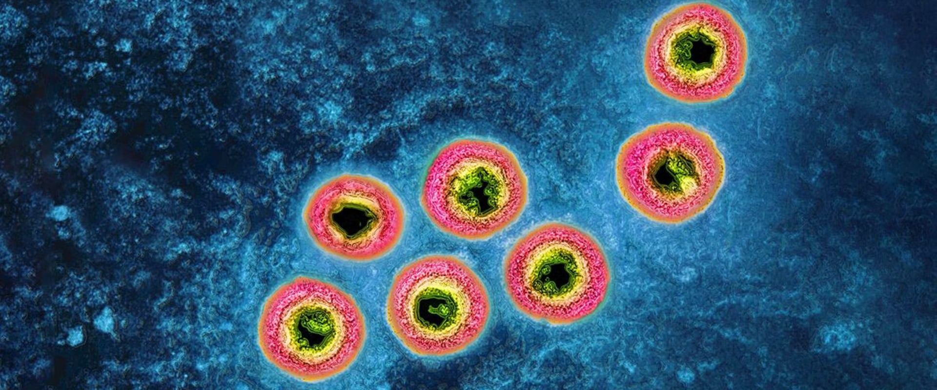 Herpes Support Society: A Comprehensive Overview